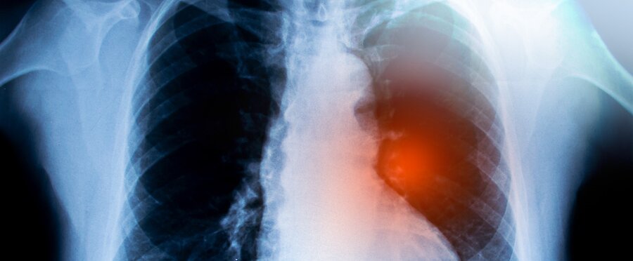 Healthcare: C/C++ & Data analytics Case Studies - ScienceSoft